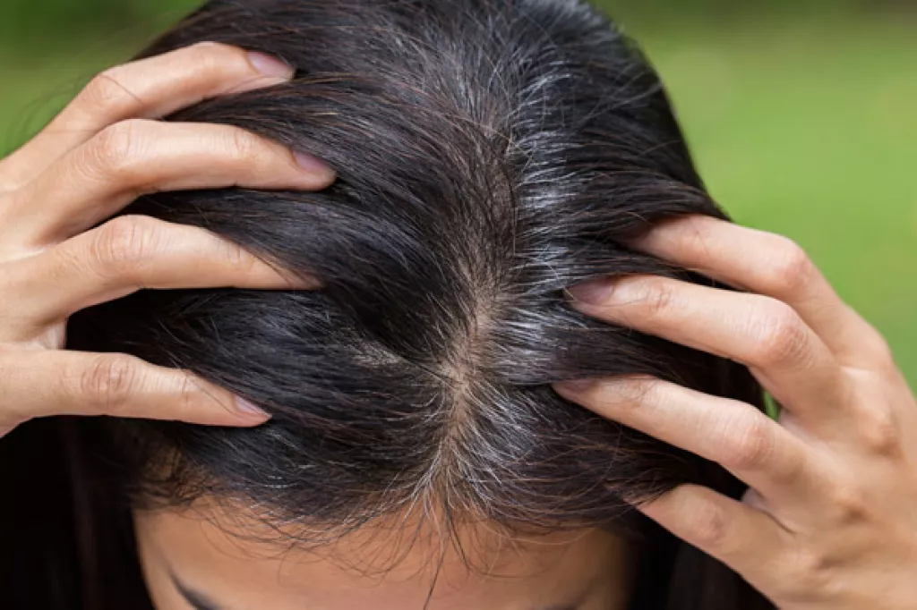 Revealing the Truth About Premature Gray Hair