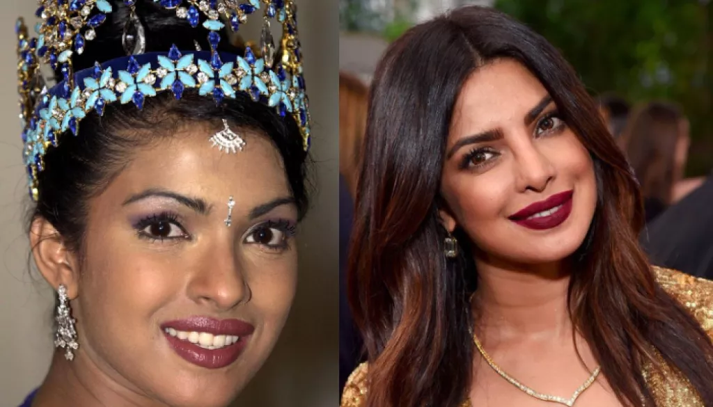 B-Town Divas Who Are Proud Of Their Plastic Surgeries And Fillers ...