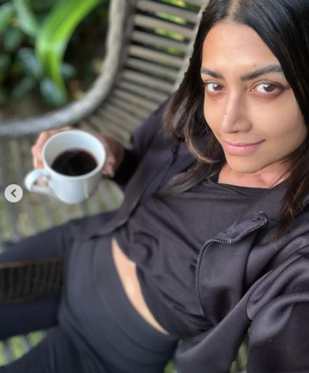 Mamta Mohandas: Diagnosed With Skin Disorder, Vitiligo, 7-Year-Long ...