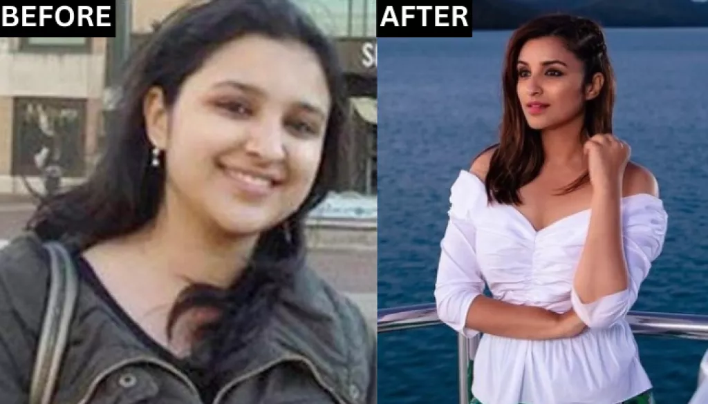 10 Celebrities Who Went Through Insane Weight Loss Transformations ...