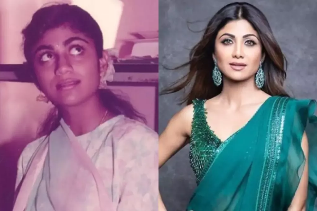 20 Divas Who Underwent Cosmetic Surgery To Enhance Beauty: Priyanka ...