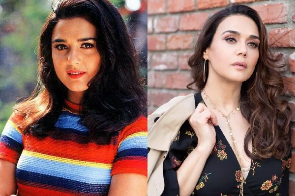 20 Divas Who Underwent Cosmetic Surgery To Enhance Beauty: Priyanka ...