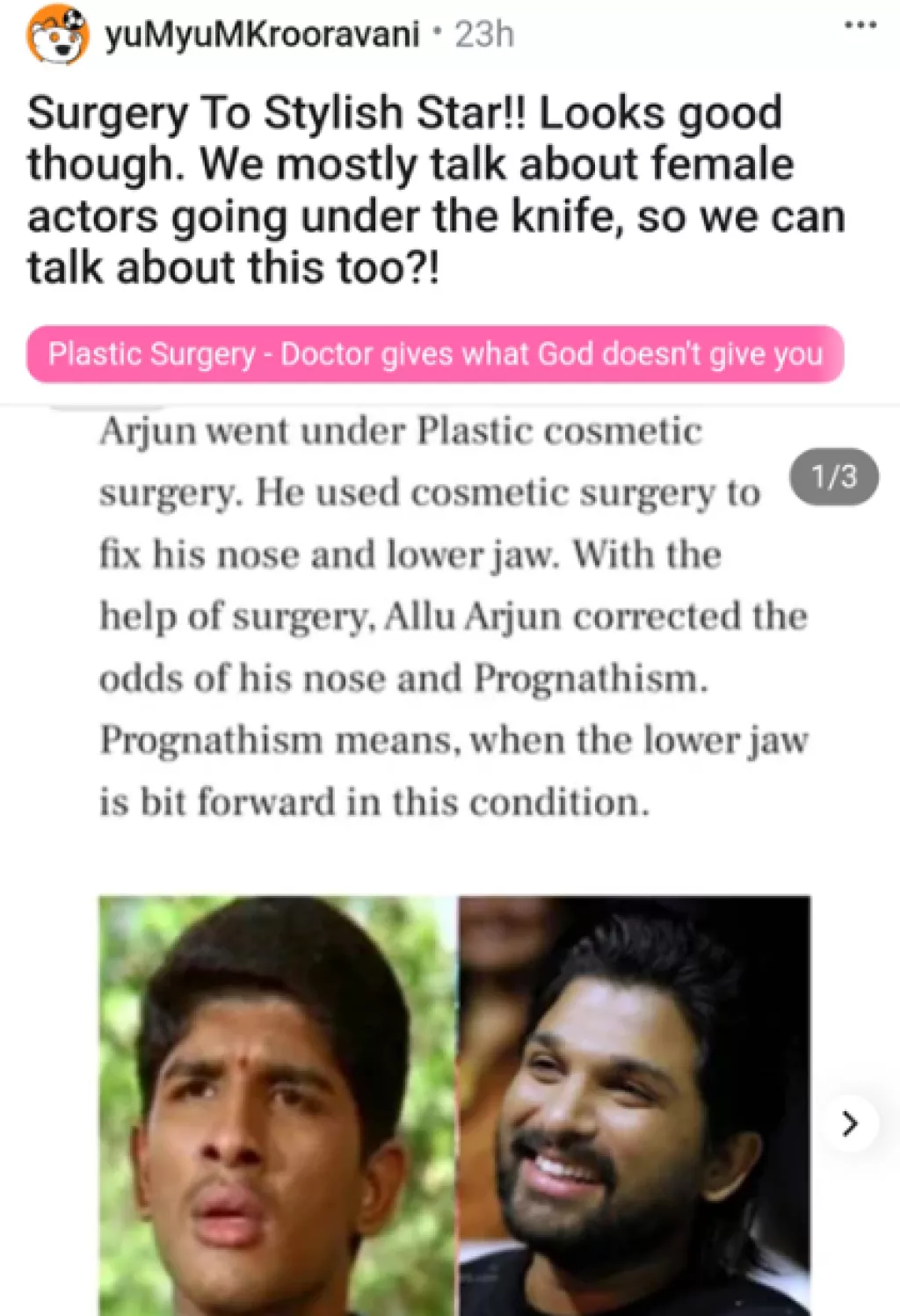 Allu Arjun Trolled For Alleged Cosmetic Surgeries, Netizen Says, 'Actor ...