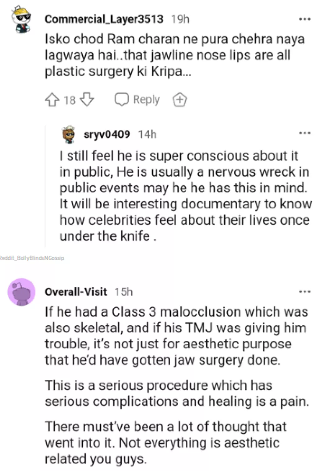 Allu Arjun Trolled For Alleged Cosmetic Surgeries, Netizen Says, 'Actor ...