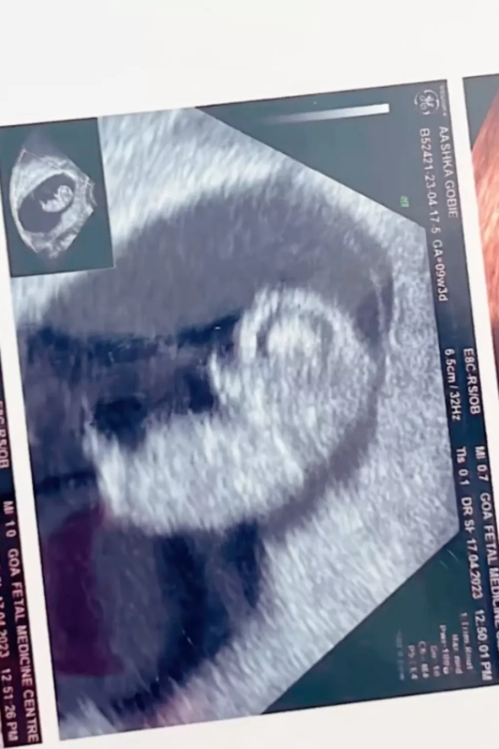 Aashka Goradia Shares Experience Of Seeing Her Soon-To-Be Born Baby's ...