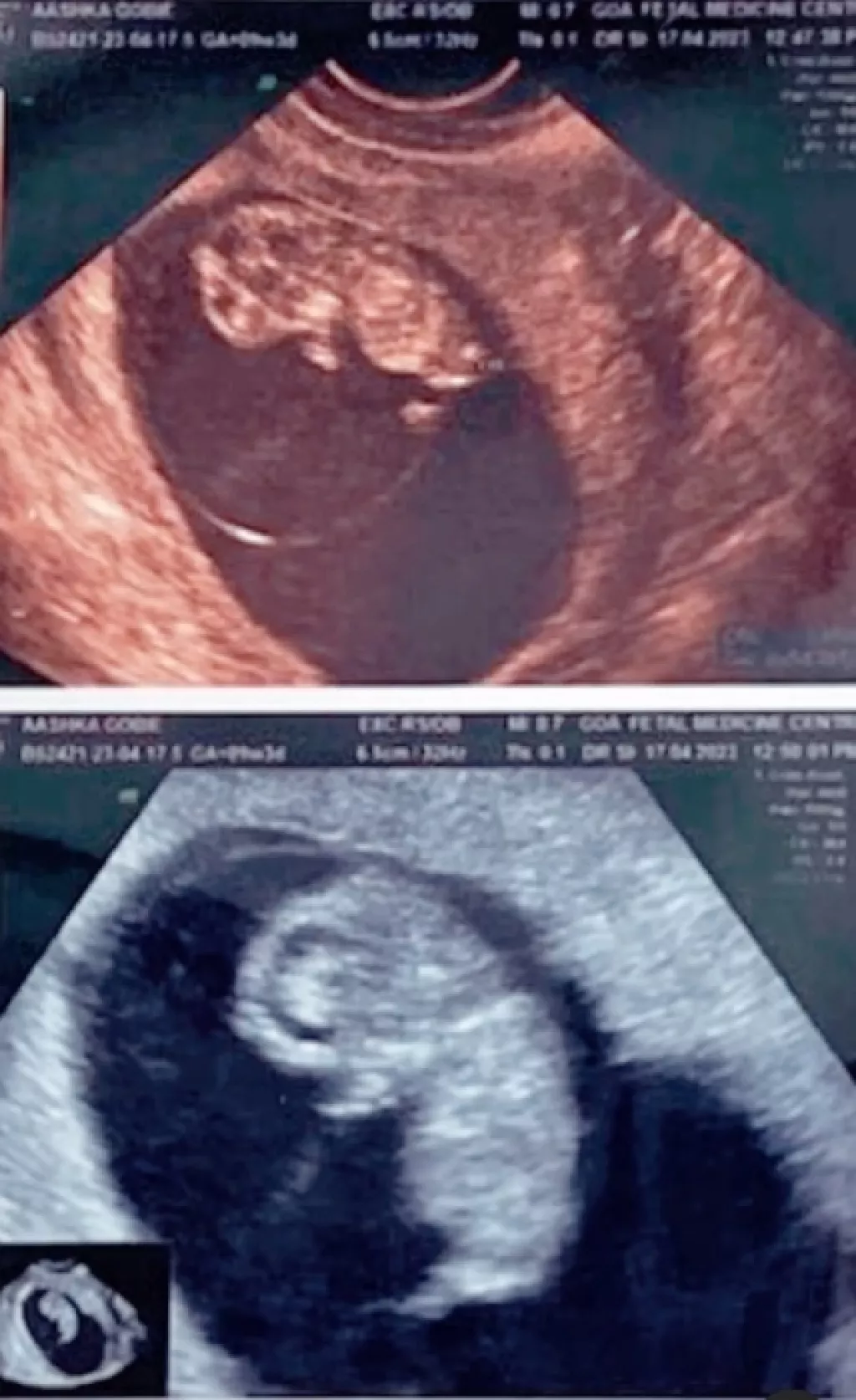 Aashka Goradia Shares Experience Of Seeing Her Soon-To-Be Born Baby's ...