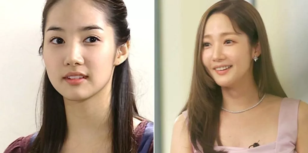 Top Hollywood and Korean celebrities who went under the knife to get ...