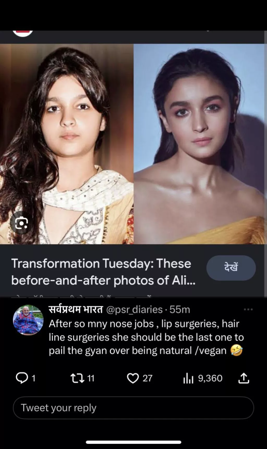 Alia Bhatt's Chubby To Hot Babe Transformation Stuns Fans, Netizen Says ...