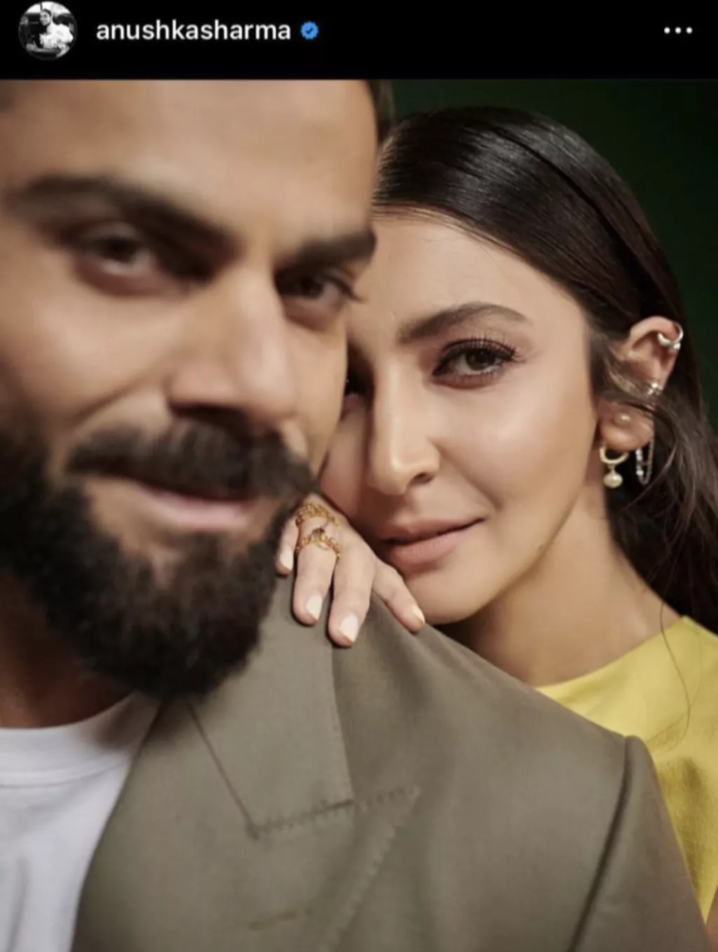 Anushka Sharma's Face Looks Weirdly Deflated In A Pic With Virat Kohli ...