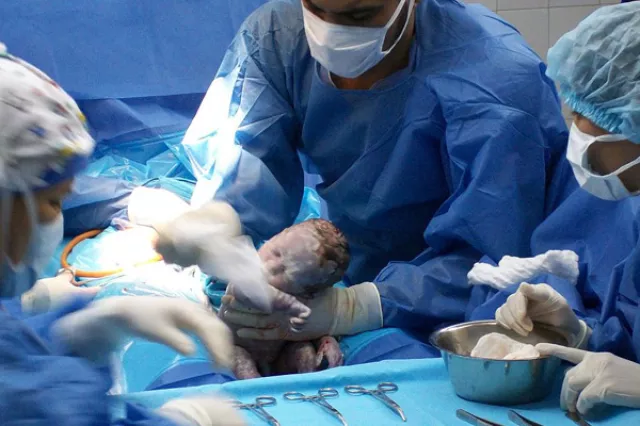 C-Section Pregnancy Guide: Who Needs It, Procedure, Complications And ...