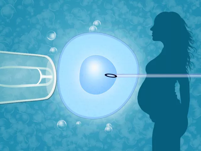 Everything You Need To Know About IVF: Benefits, Risk Factors And ...