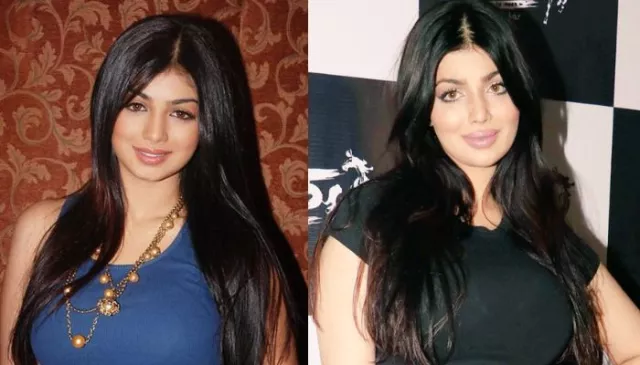 When Ayesha Takia Got Brutally Slammed For Her Lip Job, How The Actress ...