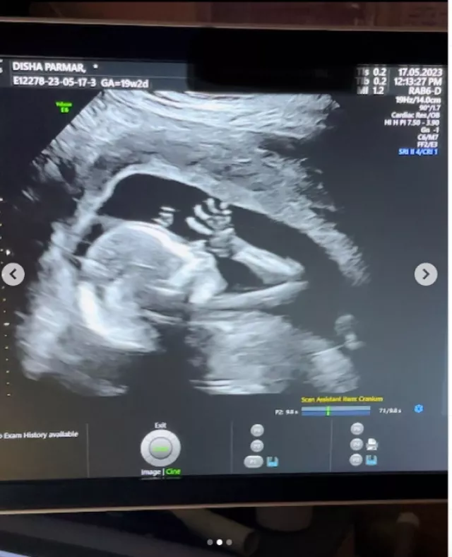 Disha Parmar And Rahul Vaidya Announce Their Pregnancy, Shares ...