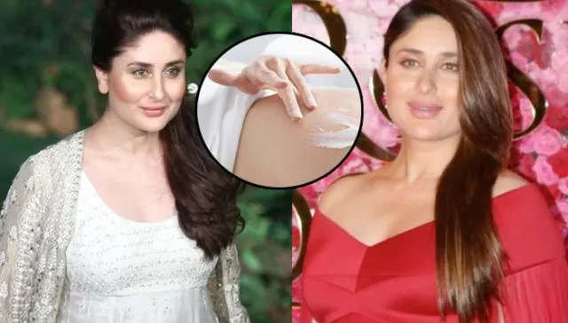 Most Common Post-Pregnancy Skin Problems And How To Tackle Them