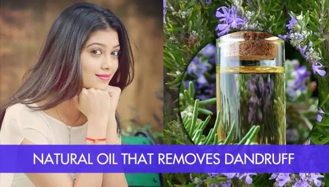 How To Get Beautiful Dandruff Free Hair In 4 Weeks