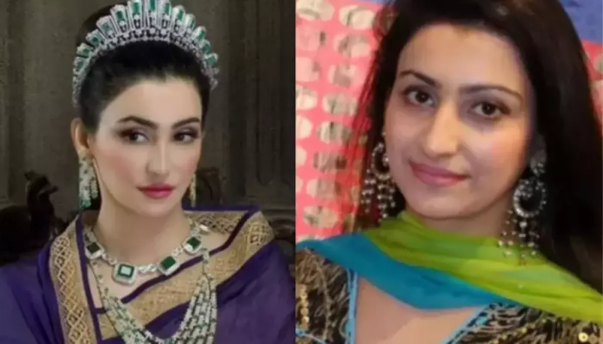 Shalini Passis Alleged Facial Transformation Revealed Botox Fillers To Non Surgical Face Lift