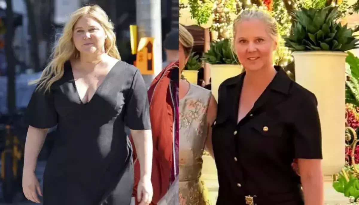 Amy Schumer’s Dramatic Weight Loss Stuns Fans, Here’s What She Revealed ...