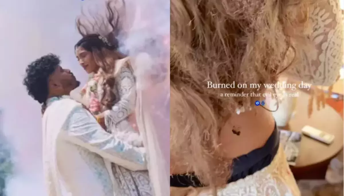 Canadian Bride Gets Burnt By Colour Bomb During Bengaluru Wedding ...