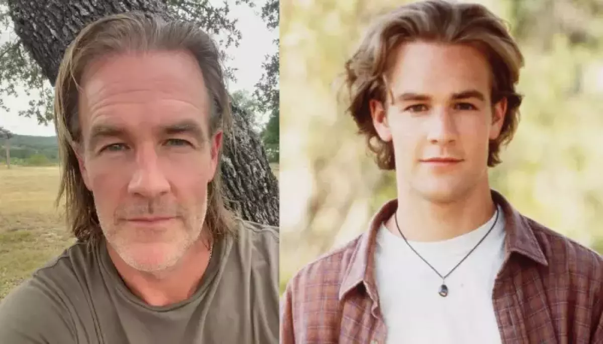 James Van Der Beek's 2-Year Colorectal Cancer Journey, 'Dawson's Creek ...
